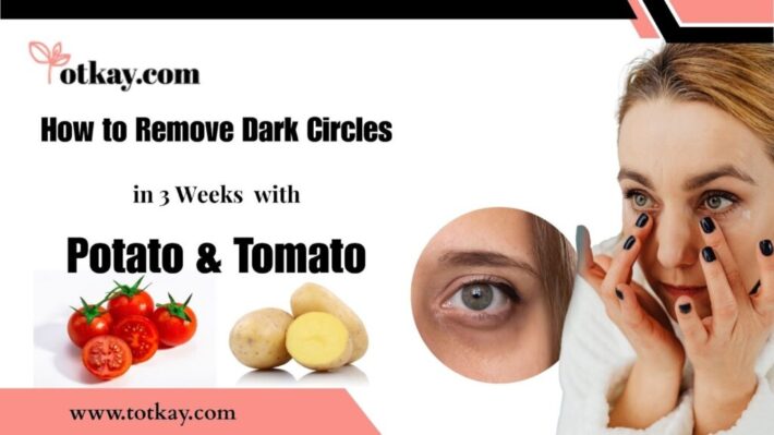 Best Natural Remedies for Dark Circles That Really Work - Totkay